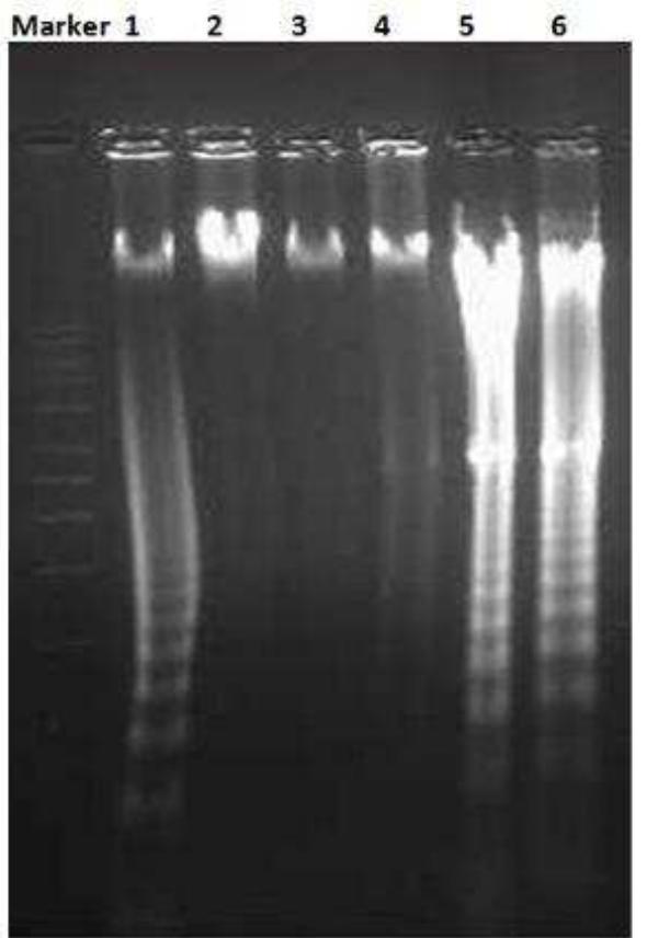 A garose gel electrophoresis displaying dna fragmentation in