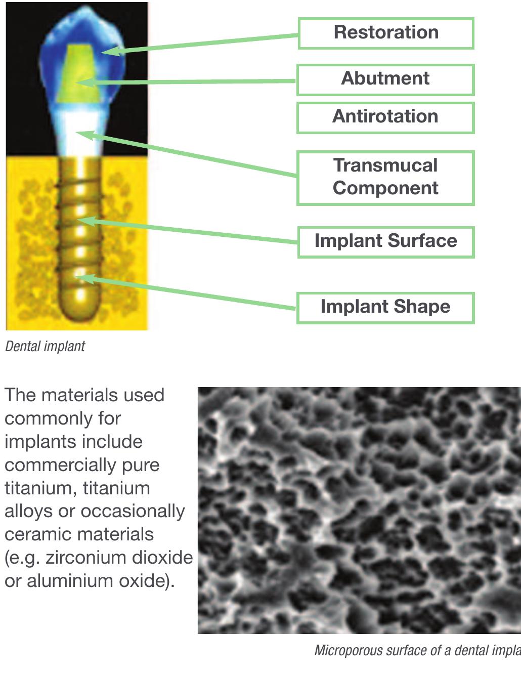 (PDF) A Dentist's Guide to Implantology