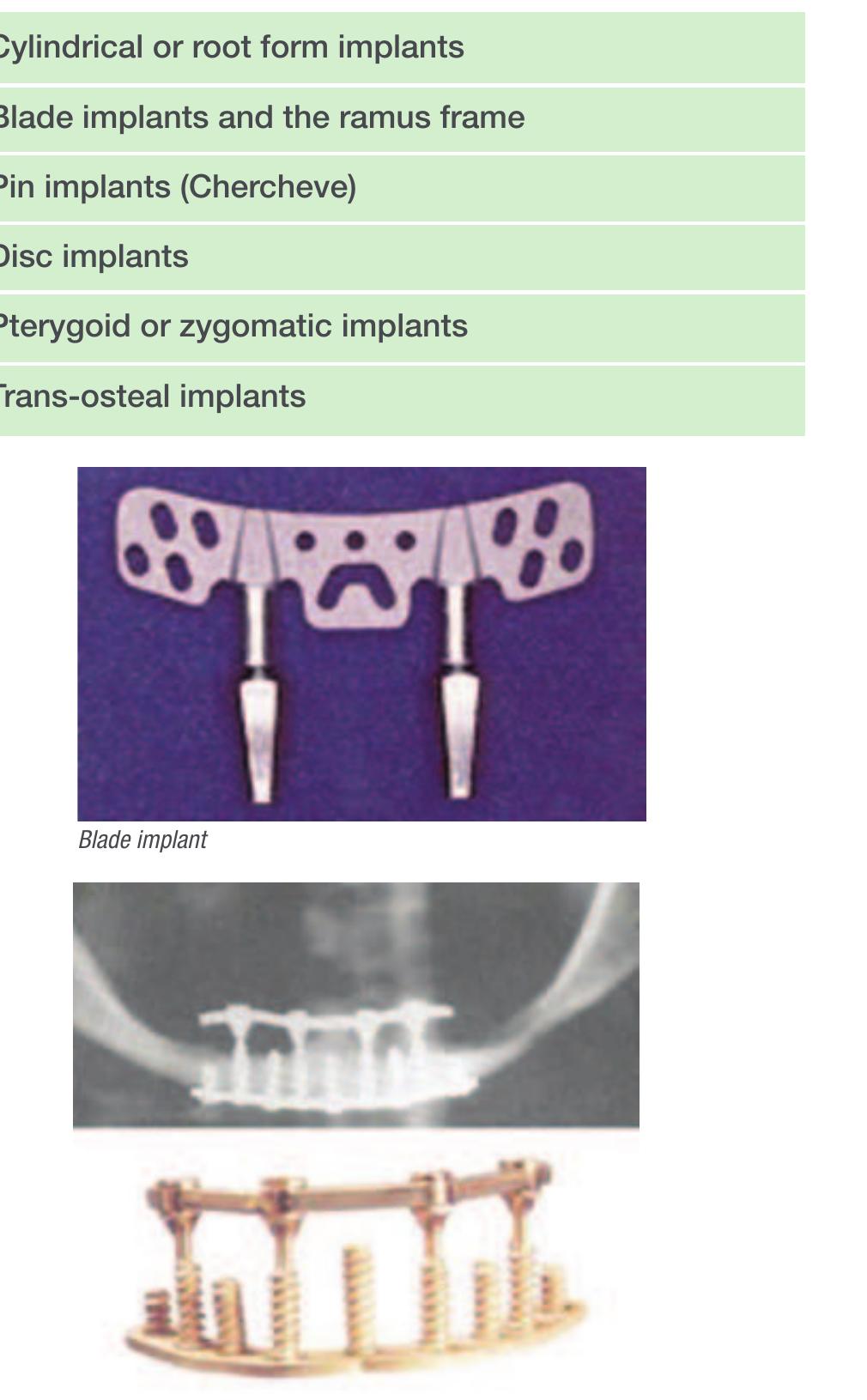 =ndosteal implants are subdivided into several different