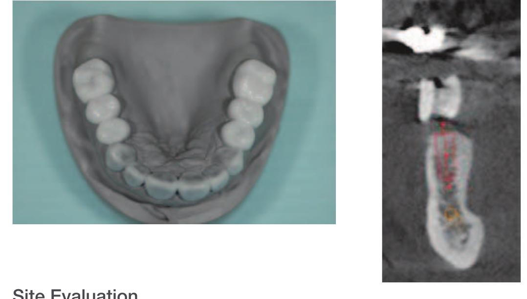 (PDF) A Dentist's Guide to Implantology