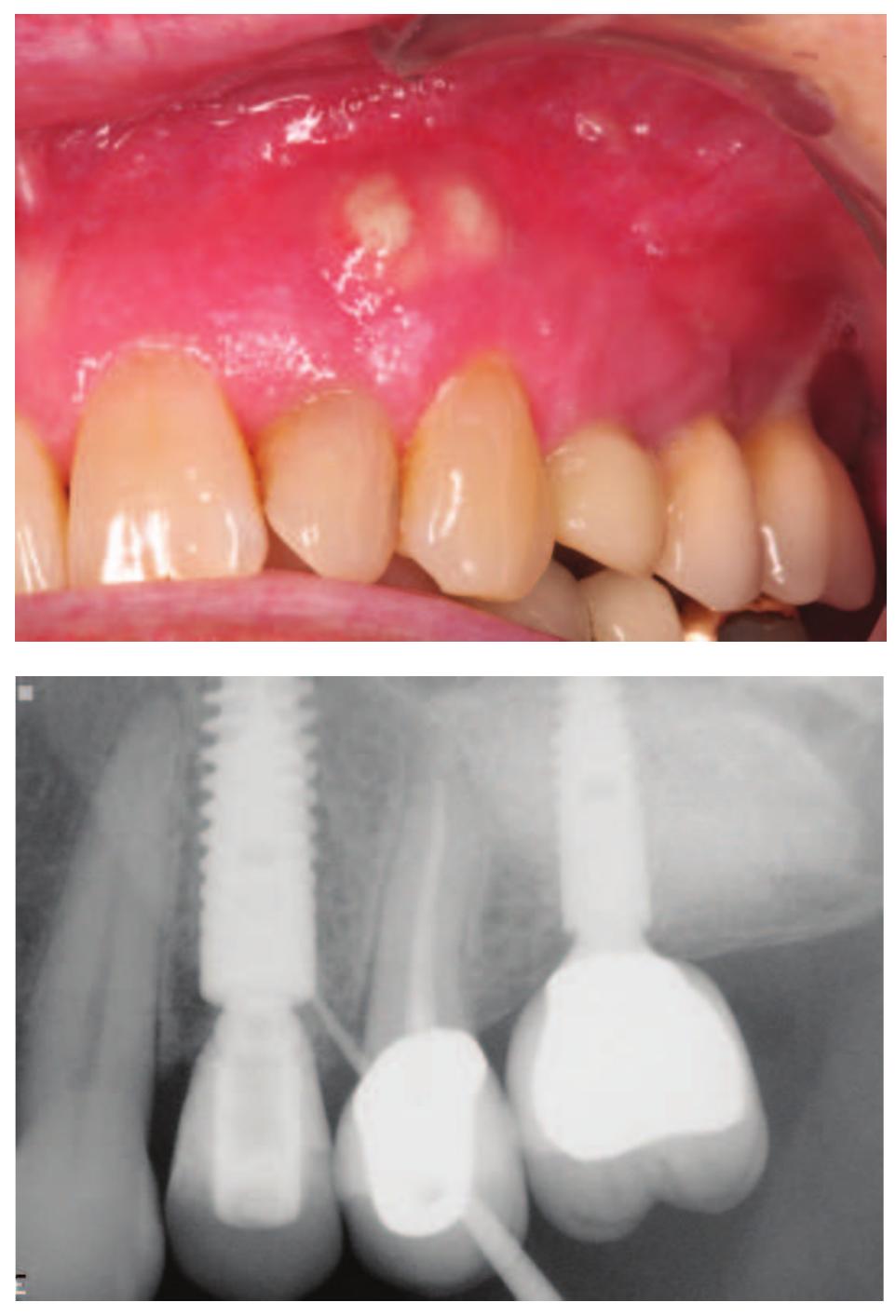 (PDF) A Dentist's Guide to Implantology