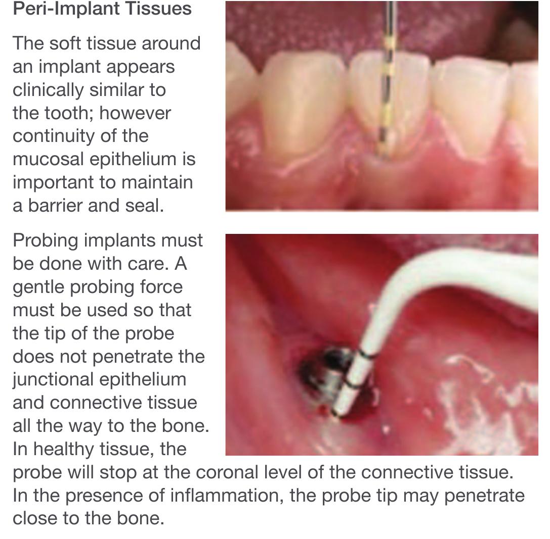 (PDF) A Dentist's Guide to Implantology