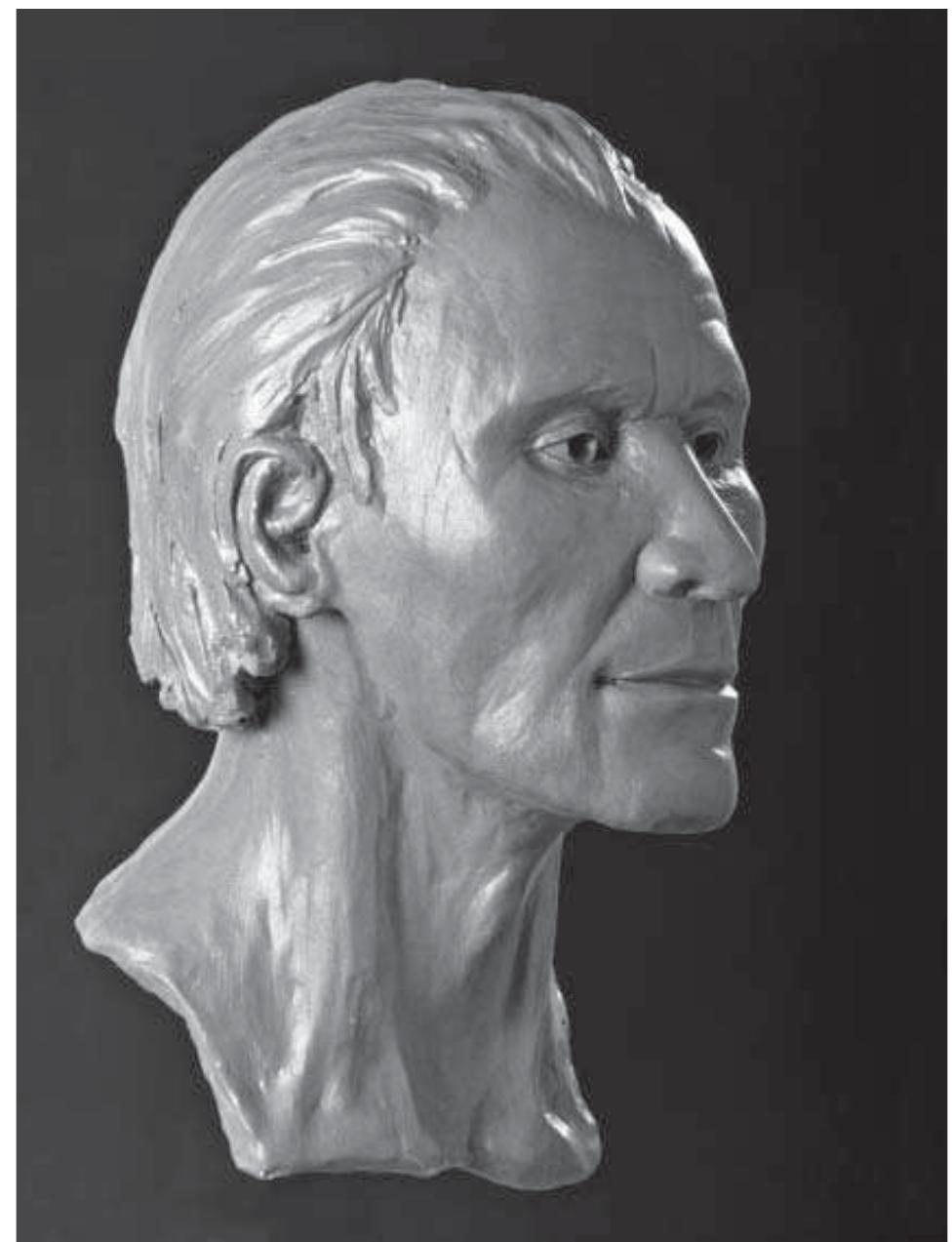 By using computer tomography the skull of the grauballe- man