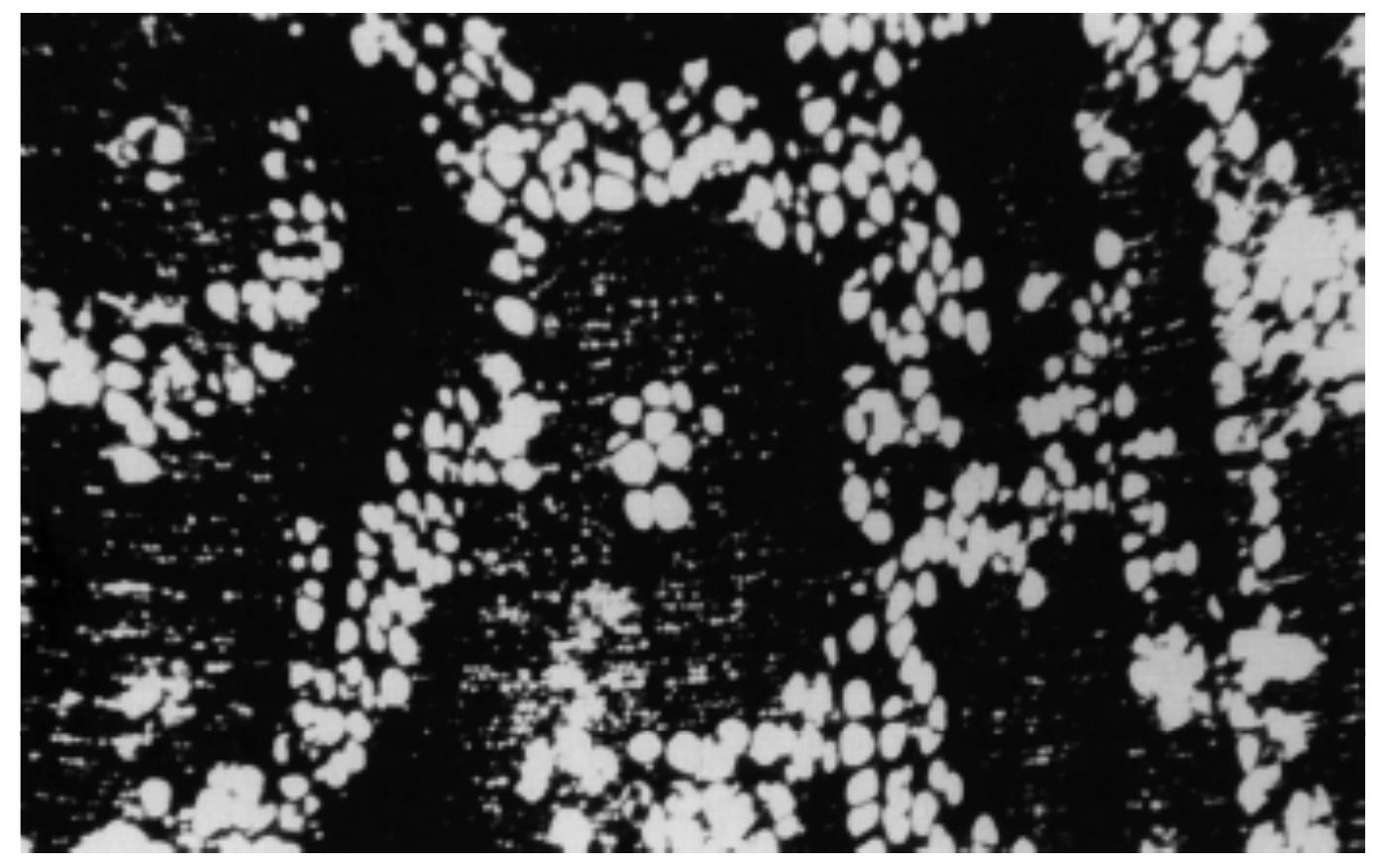 4 cellular structure of wood under a microscope. bone