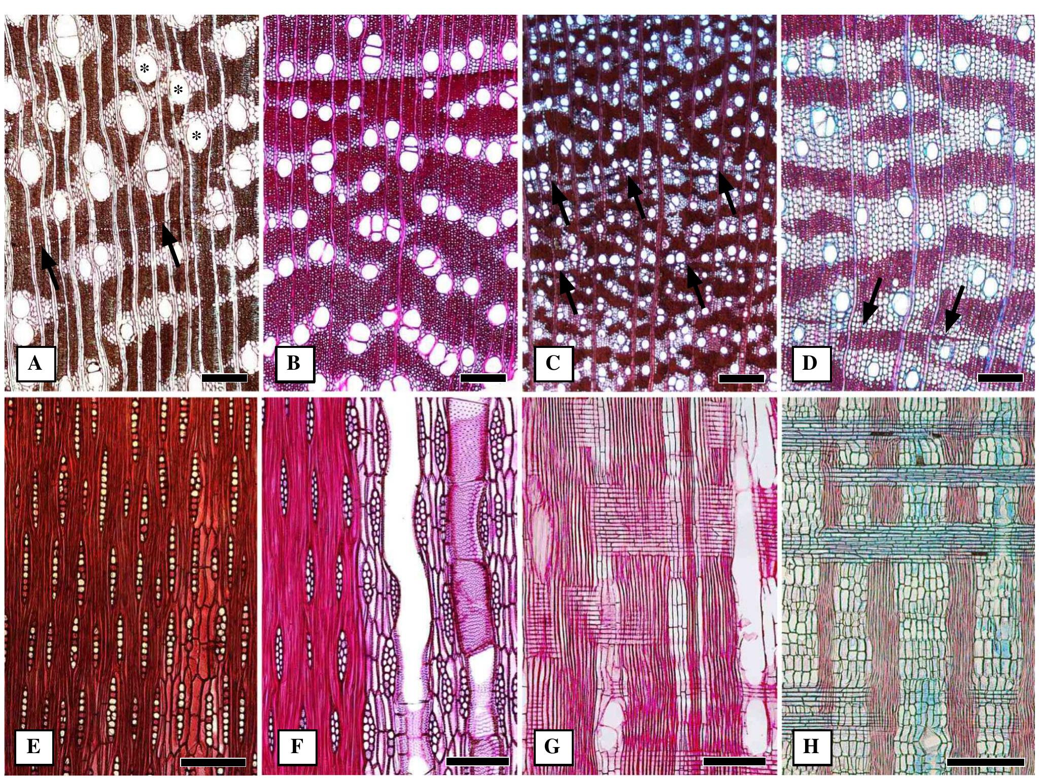 Wood anatomy of the tabebuia alliance (including crescen-