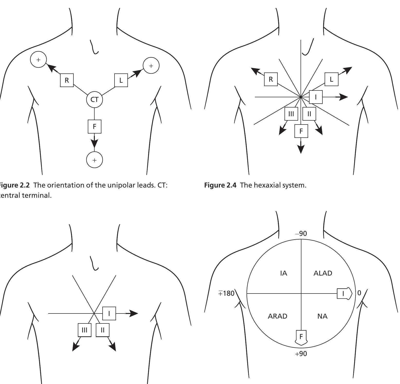 5 the quadrants of normal and abnormal axis. alad: abnormal