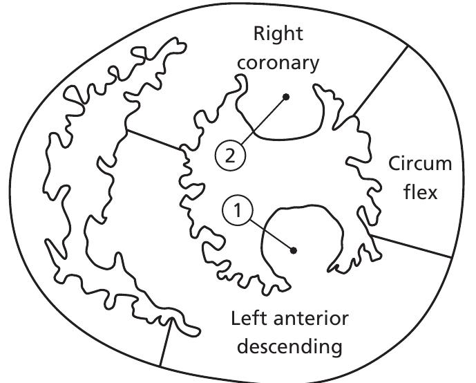 5 the major myocardial segments and their arterial supply.