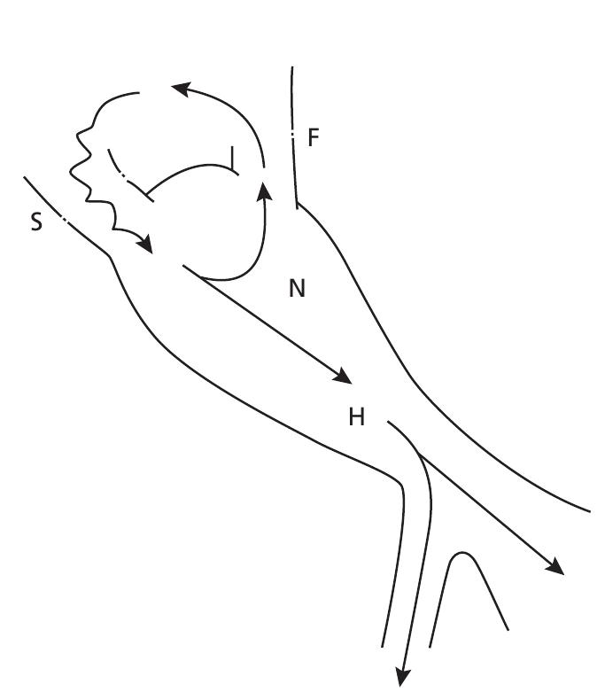 1 the mechanism of slow-fast avnrt: f: fast pathway, h: