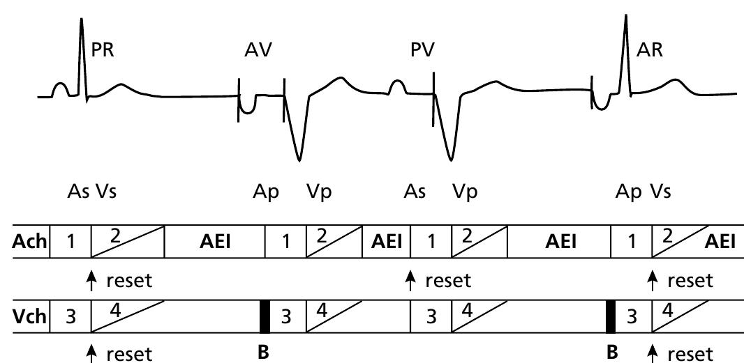Figure 283 - from ECG interpretation