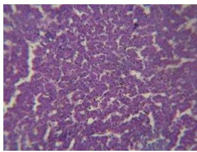Photomicrograph of chicken liver (t1) showing normal