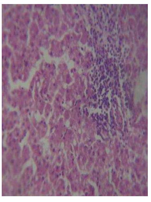 Photomicrograph of chicken liver (t3) showing mild to