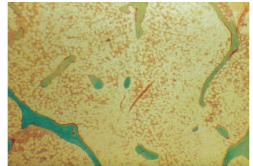 9 histological biopsy section of iliac crest bone (goldner’s