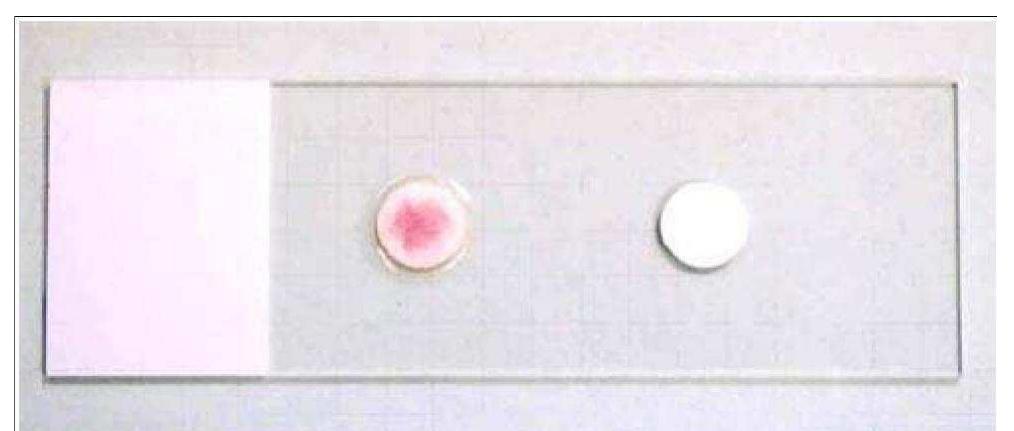 The left side shows bacteria that are resistant to optochin.