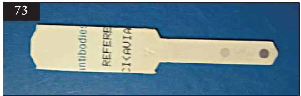 73 the immunocomb chlamydophila psittaci test is an in-house