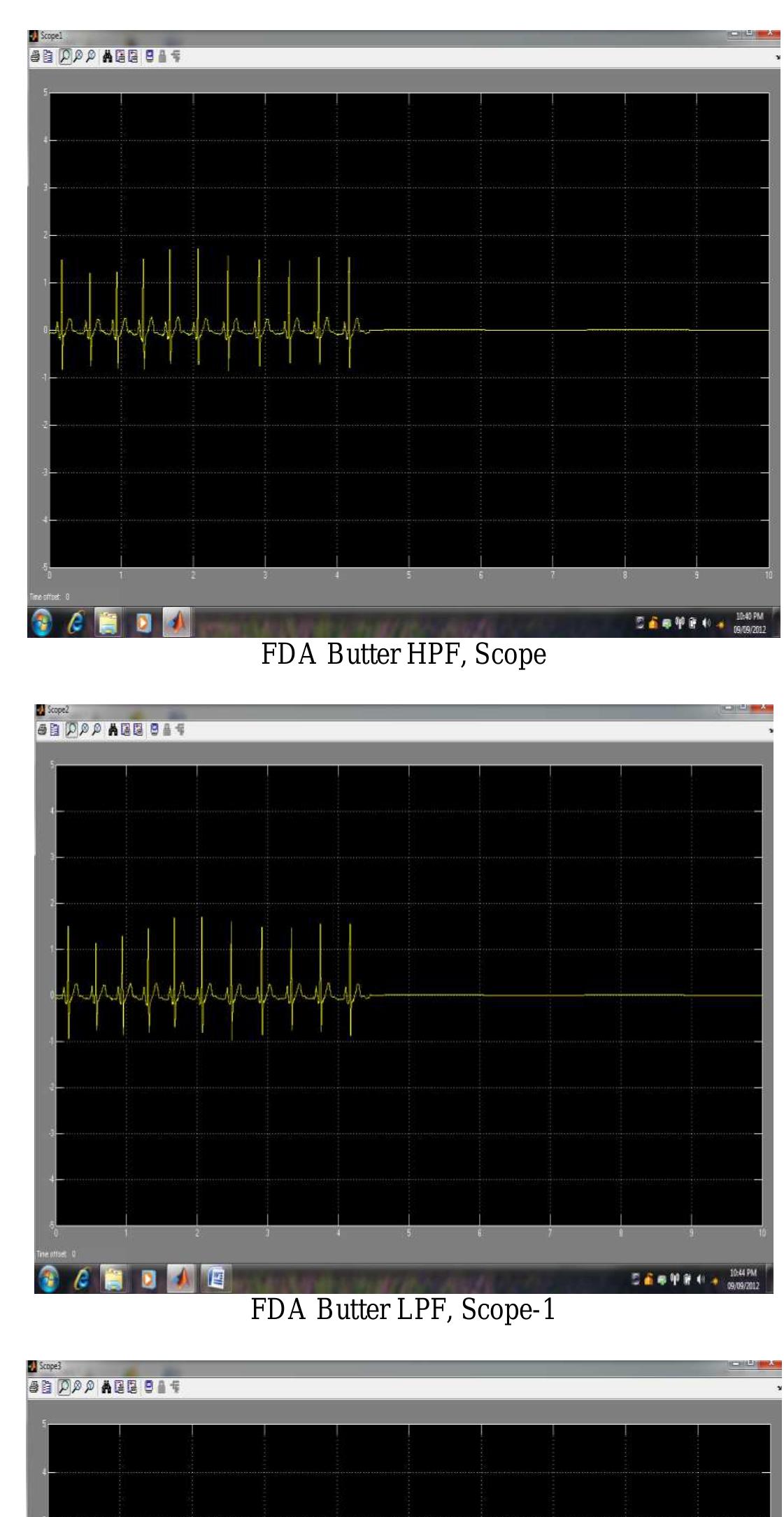 Figure 6 - Signal Processing of ECG Using Matlab