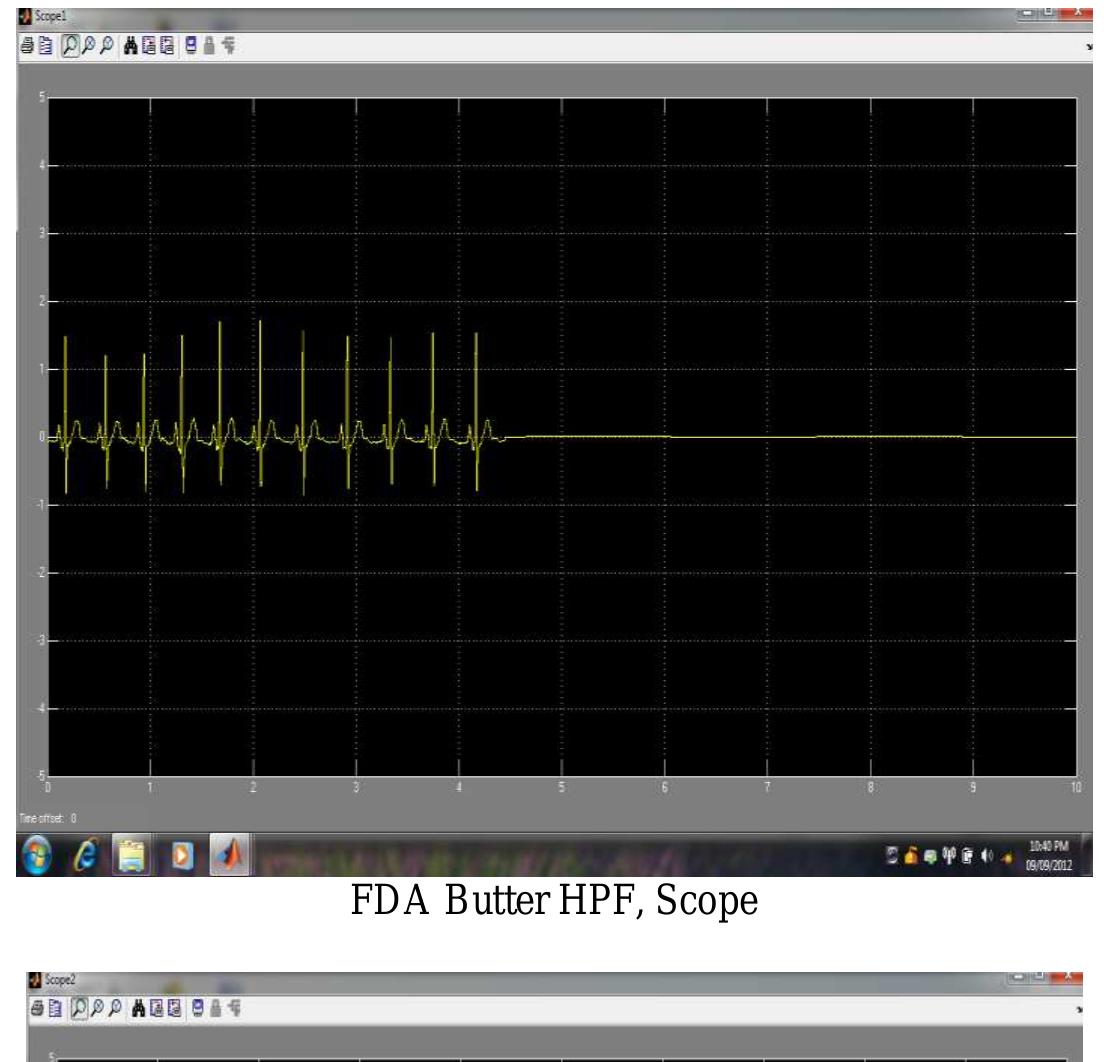Figure 8 - Signal Processing of ECG Using Matlab Figure 8 - Signal Processing of ECG Using Matlab