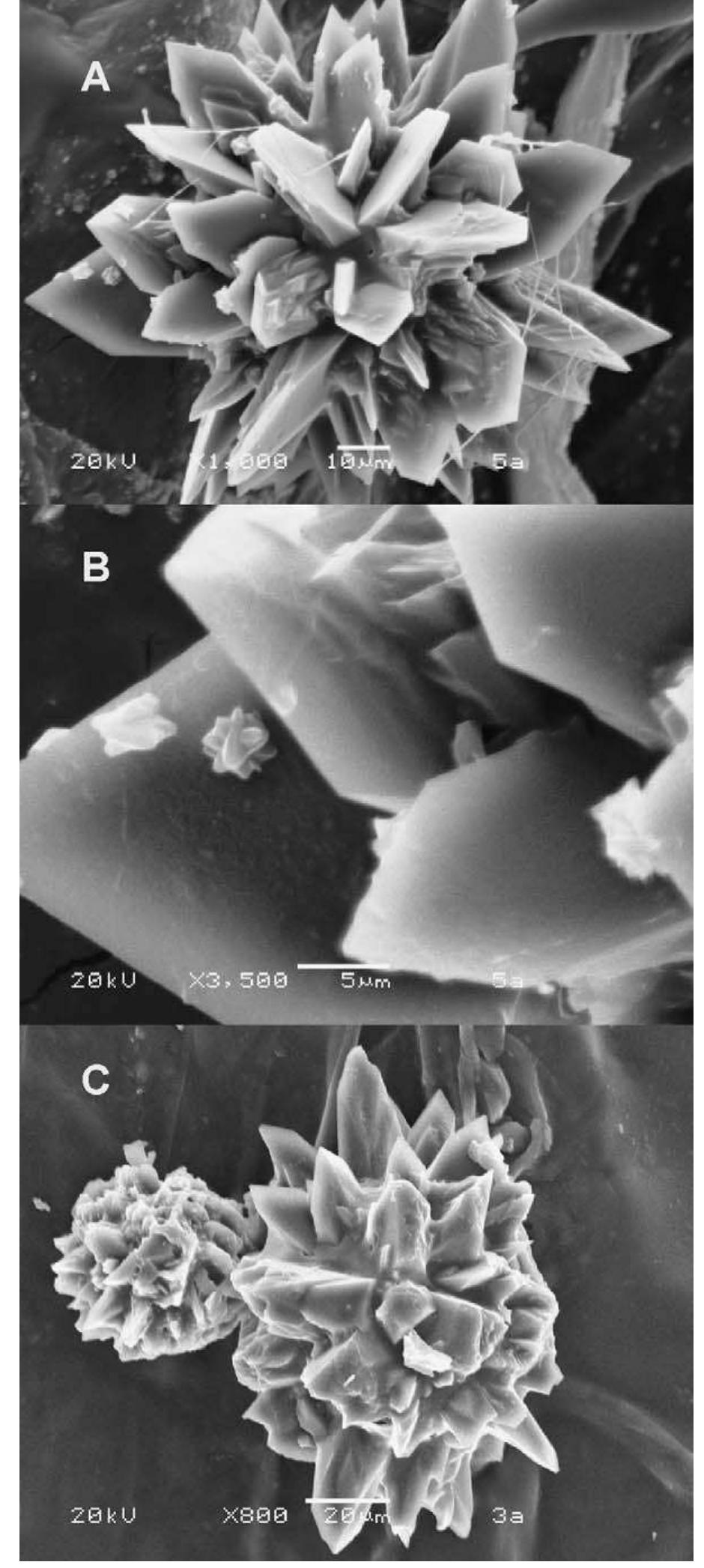 Sem images of calcium oxalate: (a) oxalate morphology 1000x