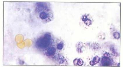4 urease test (christensen’s urea broth). right: a positive
