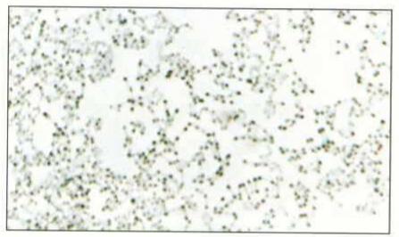 $2 albert stained smear of corynebacterium diphthe- riae