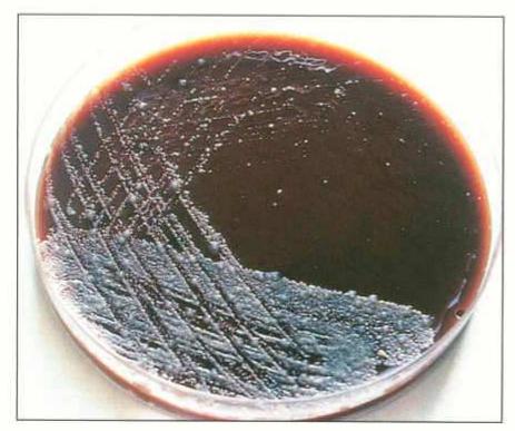 40 cervical swab culture of neisseria gonorrhoeae (smallest