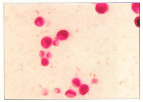 74 yeast cells of cryptococcus neoformans in gram stained