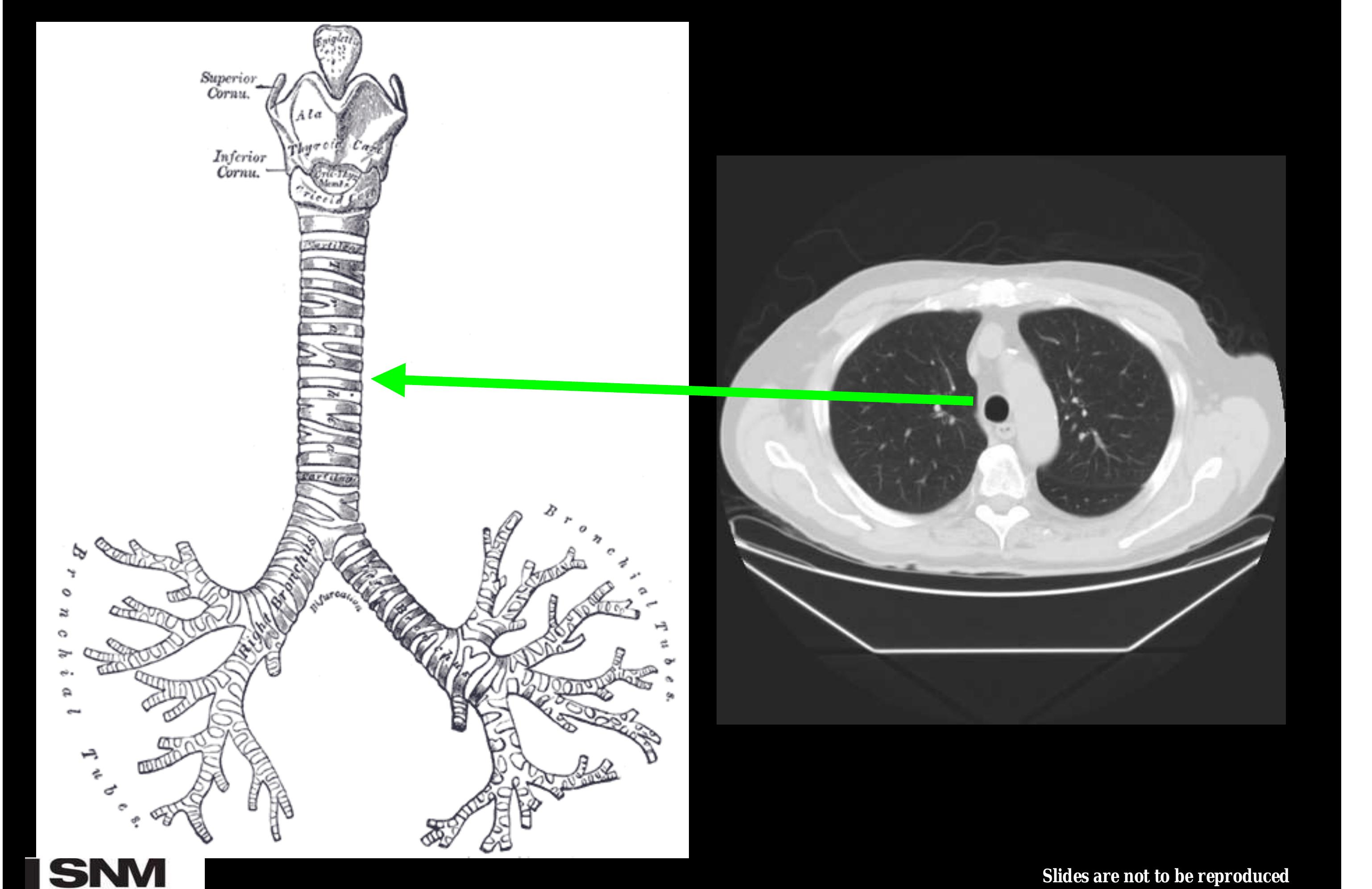 Figure 48 - from Cross Sectional Anatomy of the Chest,