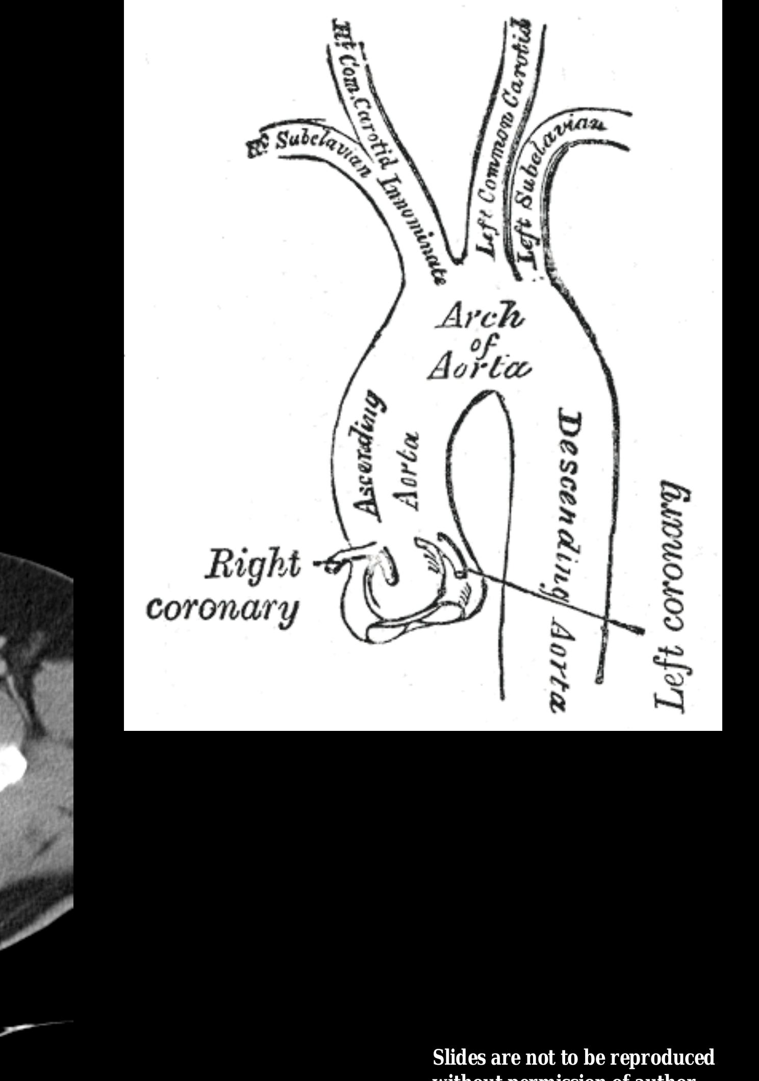 Figure 72 - Cross Sectional Anatomy of the Chest, Abdomen,
