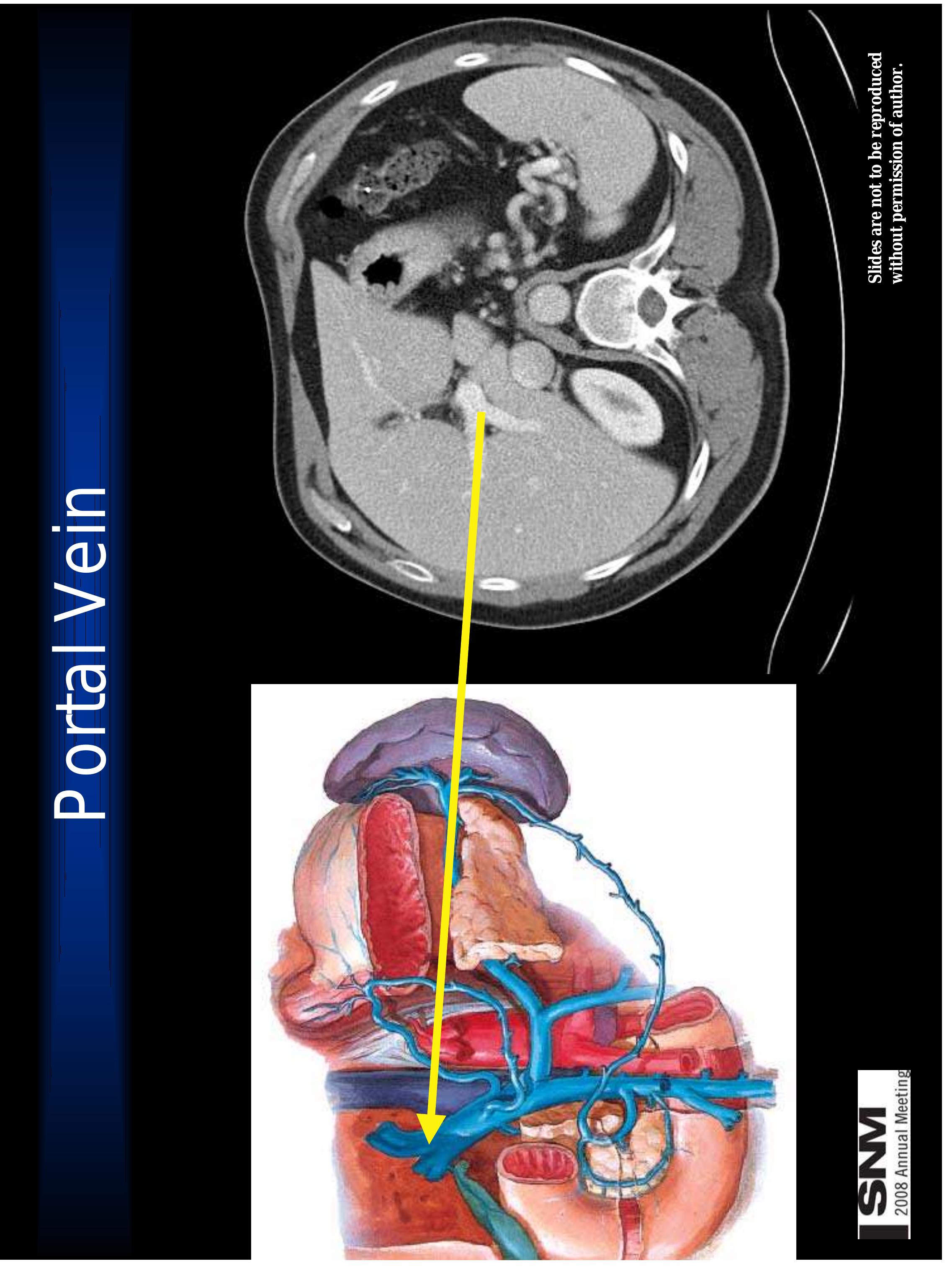 Figure 193 - Cross Sectional Anatomy of the Chest, Abdomen,