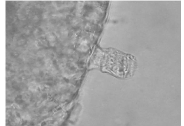 Irichodinids are the most common ectoparasites or fish and