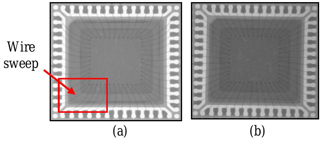 X-ray image demonstrates the visual comparison of wire sweep