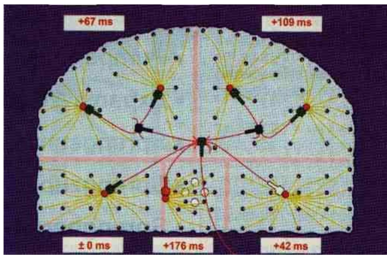 F igure.76 - example of an explosion scheme for drill and