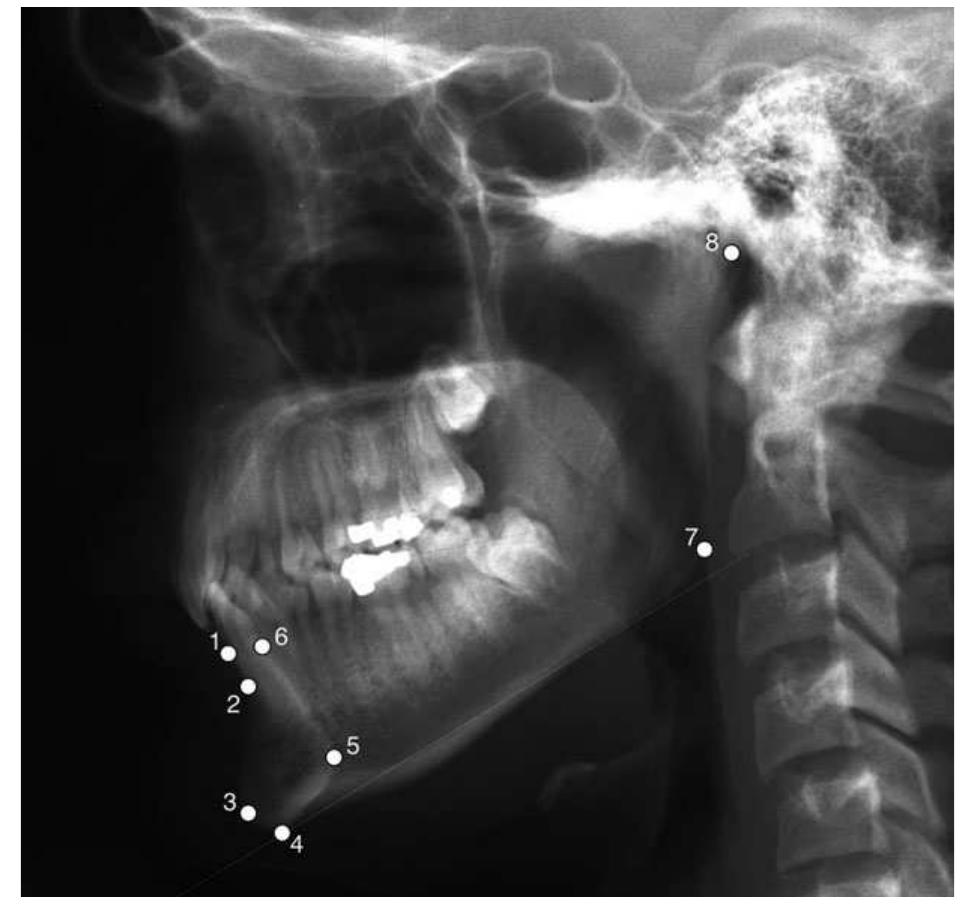 Landmarks used to quantify mandibular shape. 1 = infraden-