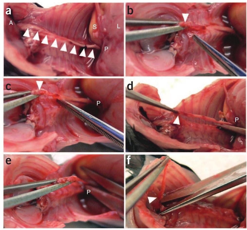 Figure 1 - Use of the mouse aortic ring assay to study