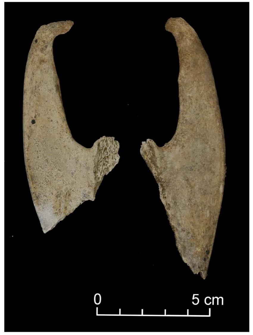 Coronoid process of the left and right mandible of the