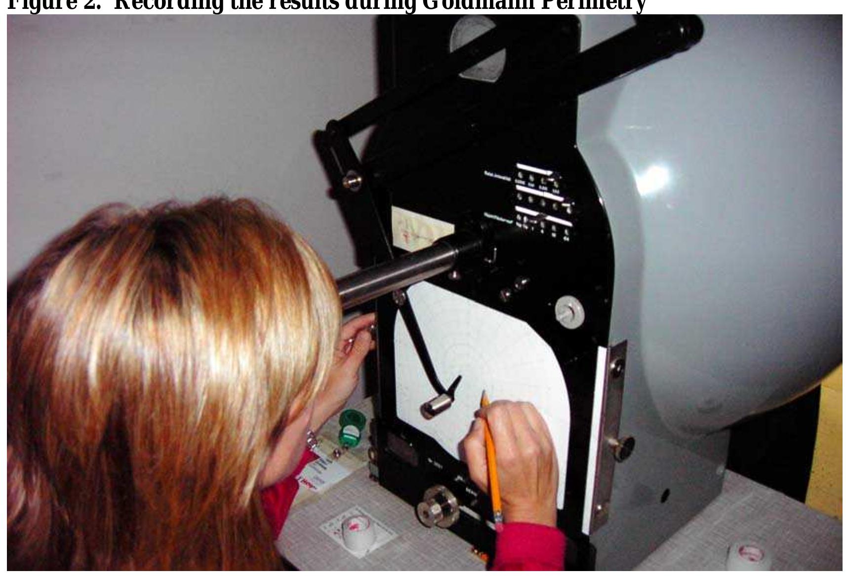 (PDF) Understanding Visual Fields: Goldmann Perimetry