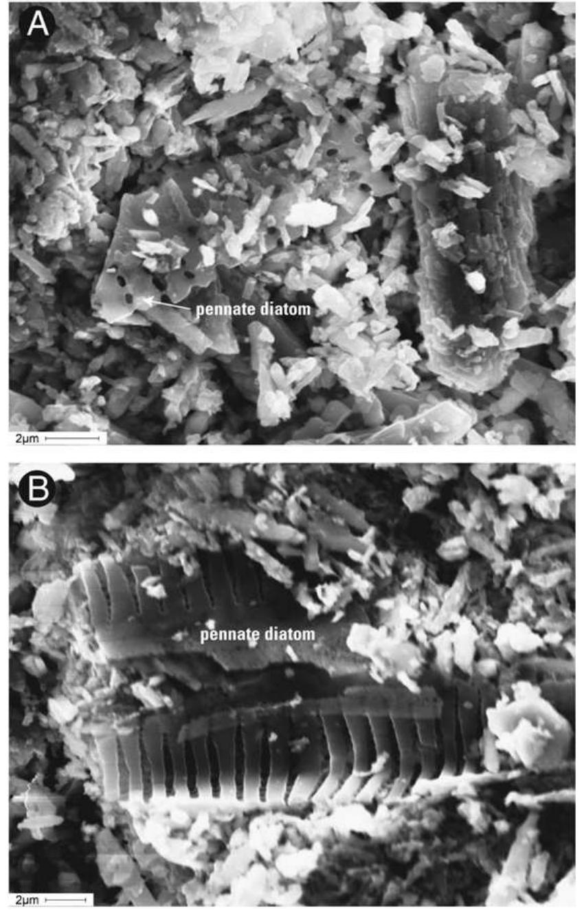 Scanning electron microscope (sem) photographs of pennate
