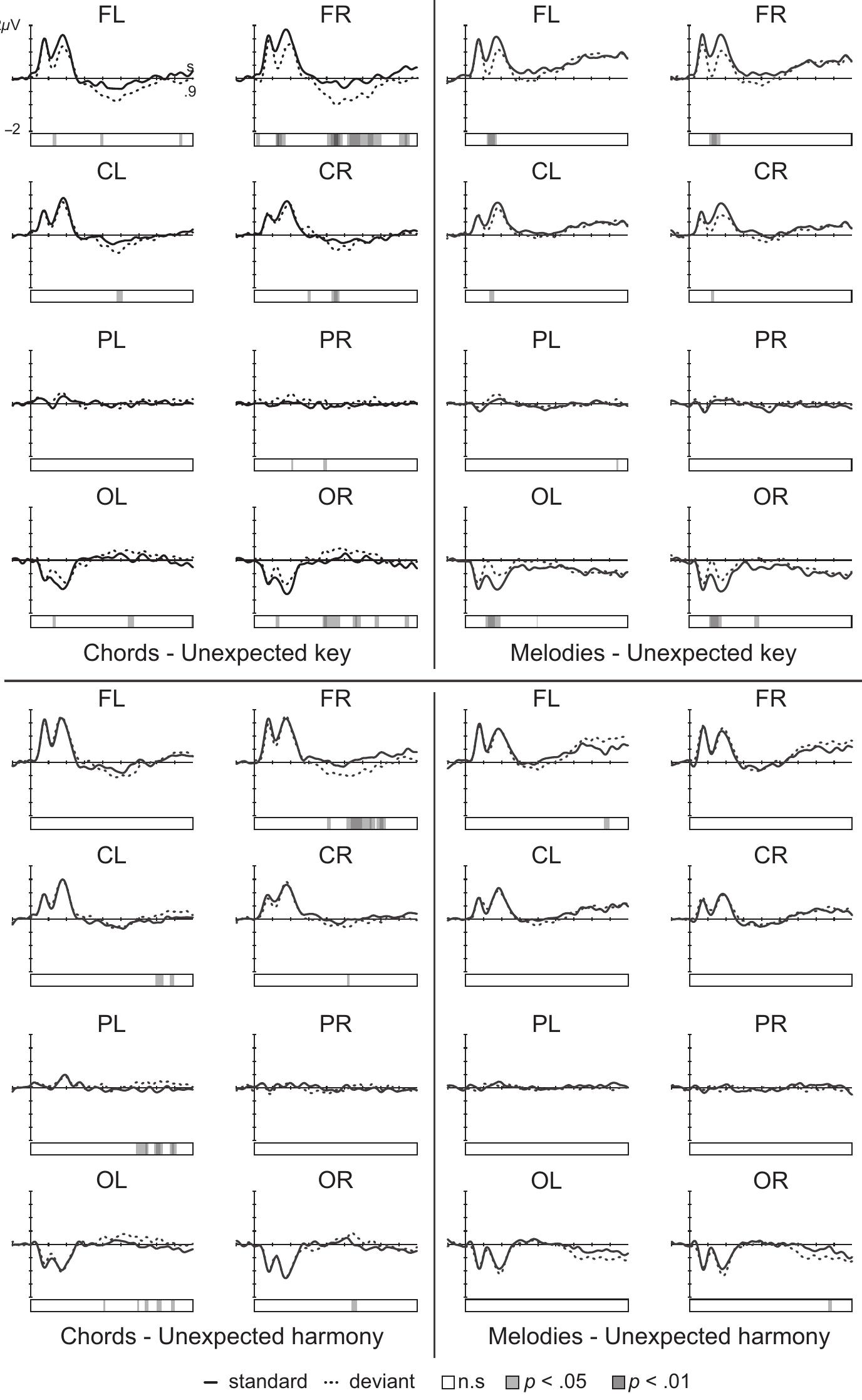 Grand average waveforms of responses to standards (black