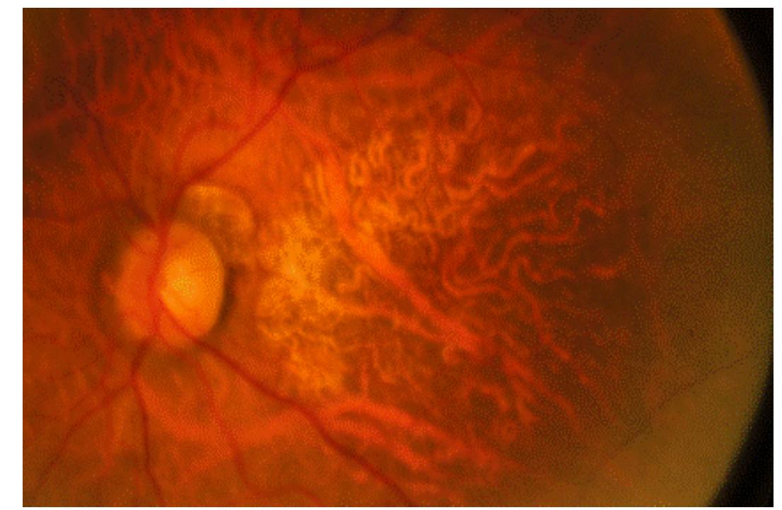Microphotography of the choroid. histological aspect of