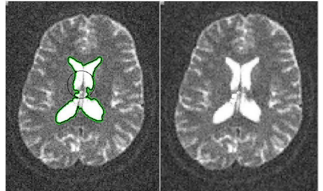 (a). 400 iteration of hard mumford- shah model, (b). after
