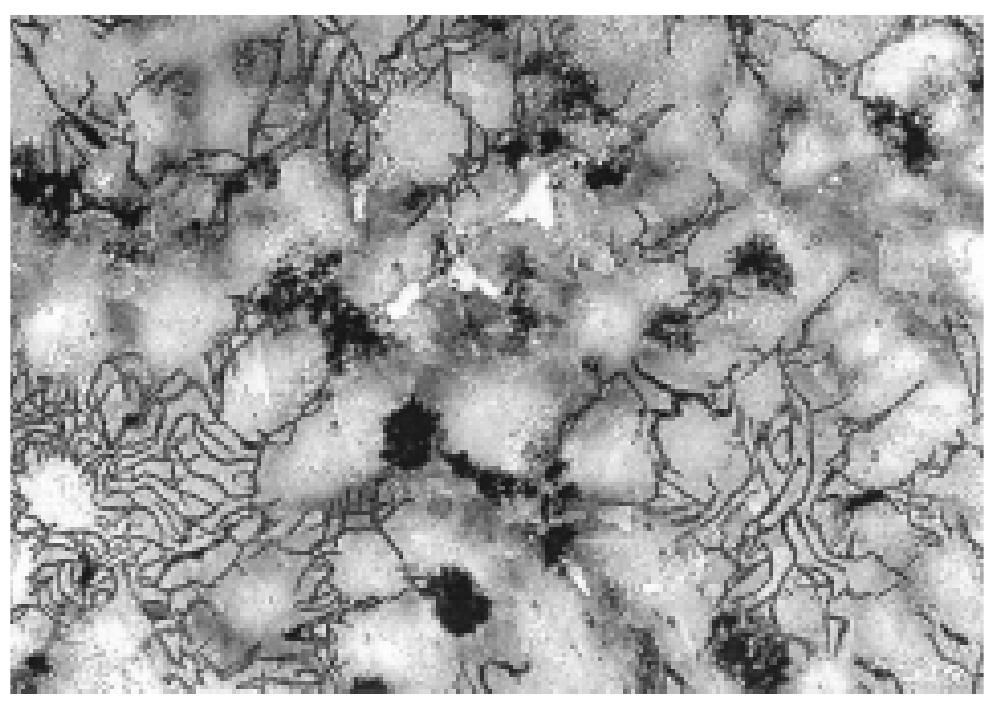 Figure 33 - from Cast Iron Microstructure Anomalies and