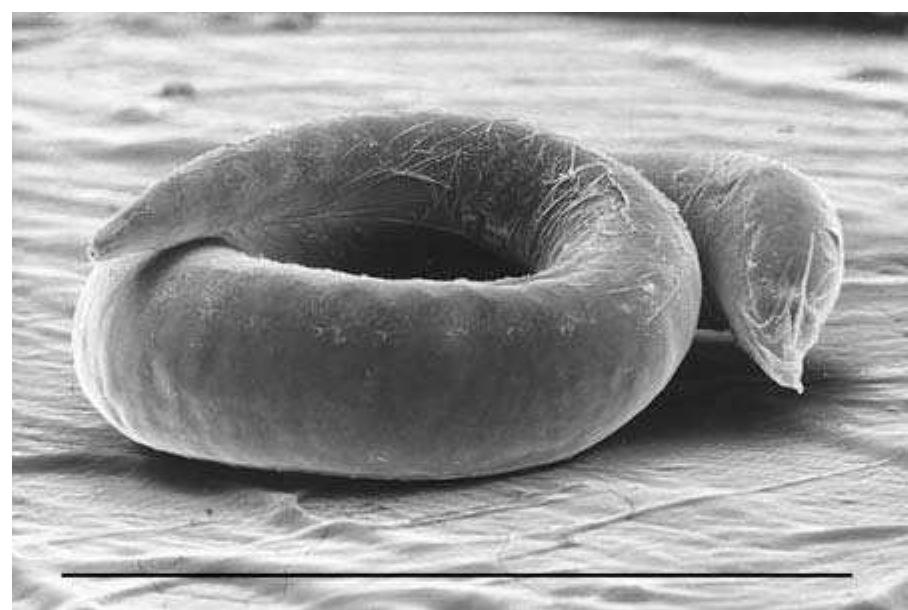 A rhabdias bufonis (female), a nematode belonging to class