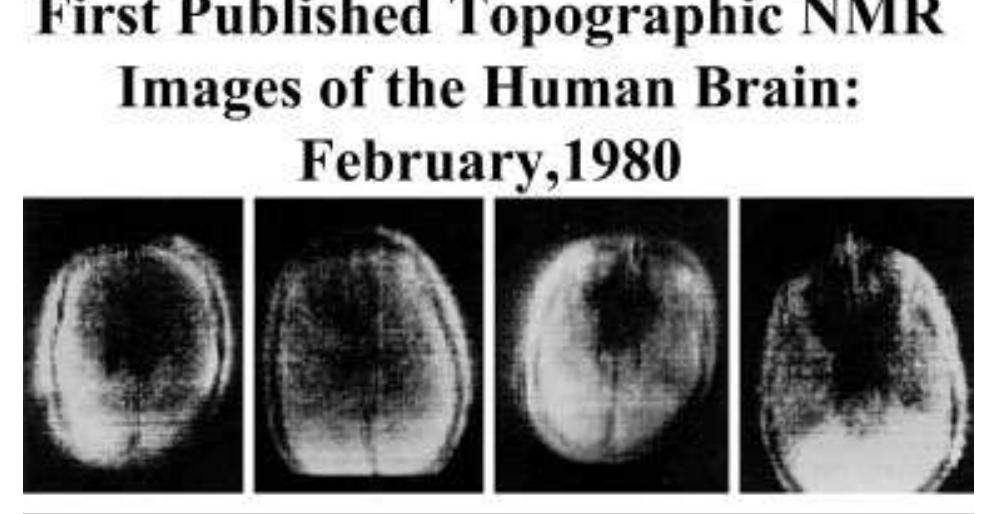 In 1980, the first topographic nmr images were per- formed