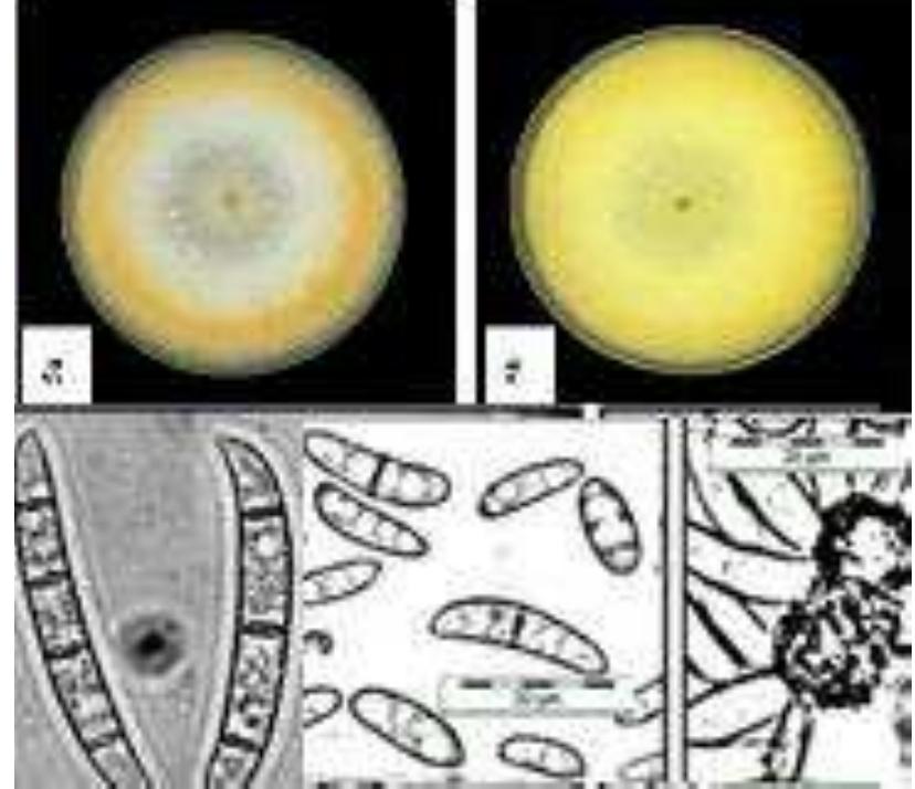 Figure 126 - from Monograph on the genus Fusarium