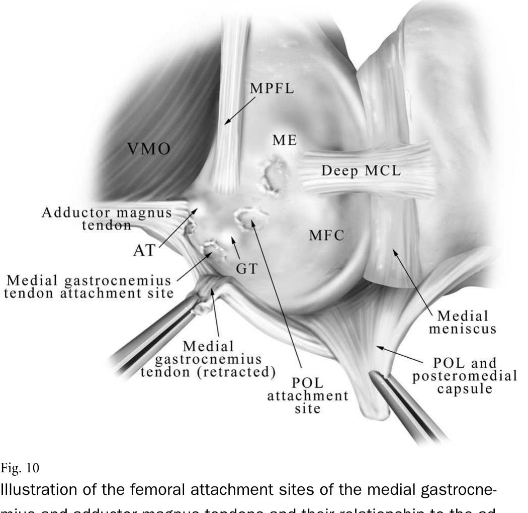 Figure 12 - The Anatomy of the Medial Part of the Knee