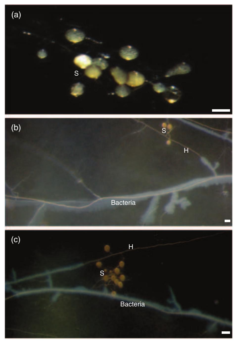 (a) the morphology of spores (s) isolated from soil. (b, c)