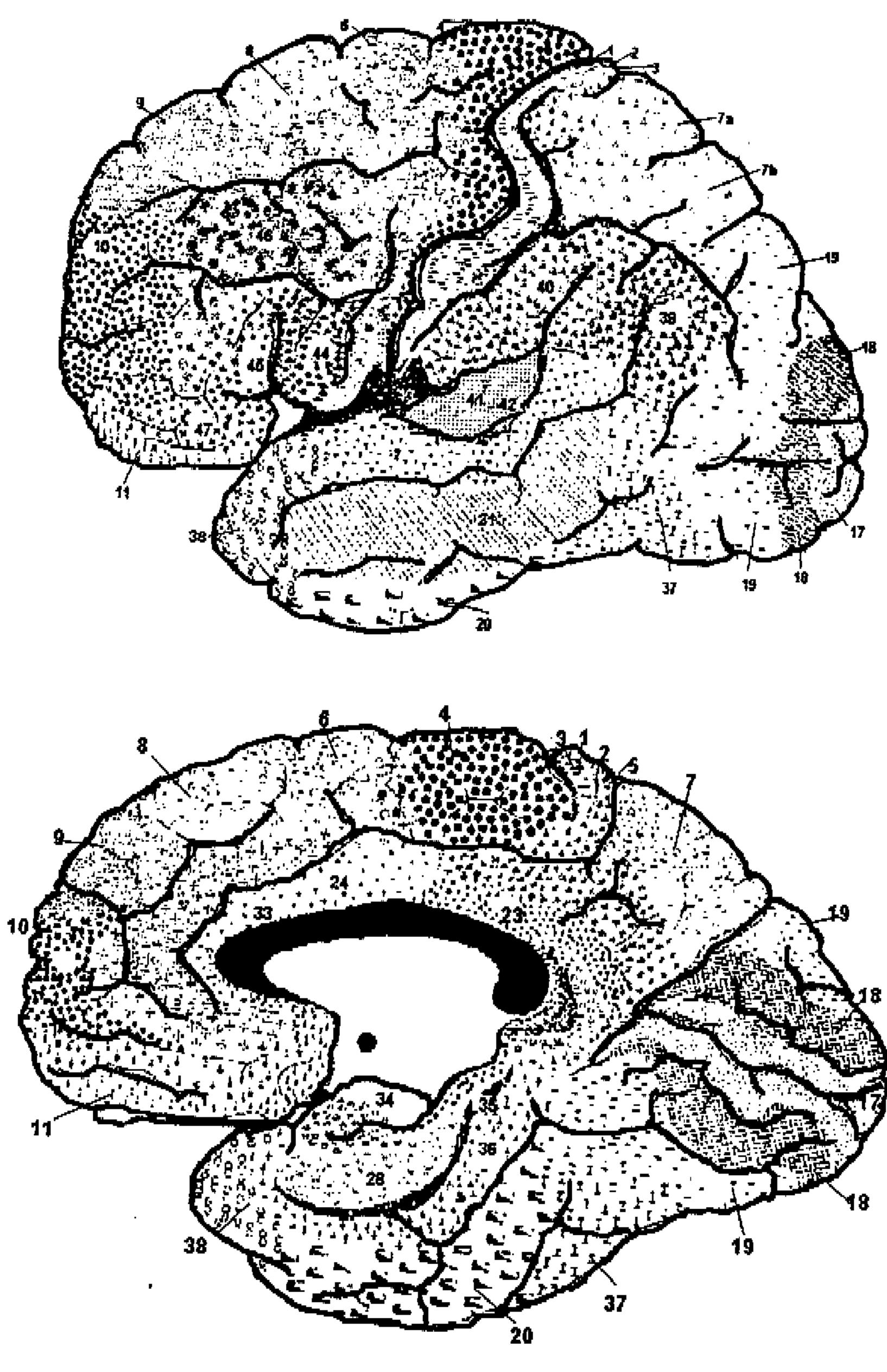 5. a map of cytoarchitectonically defined cortical areas
