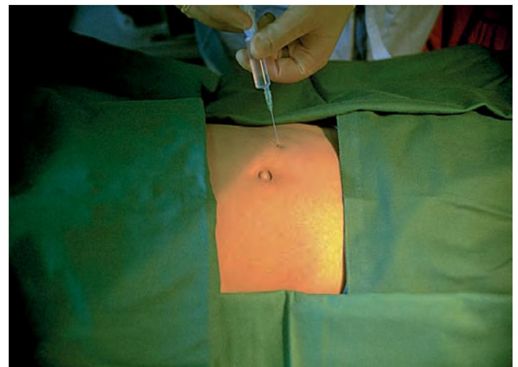 Figure 221 - Endoscopy of the Upper GI Tract