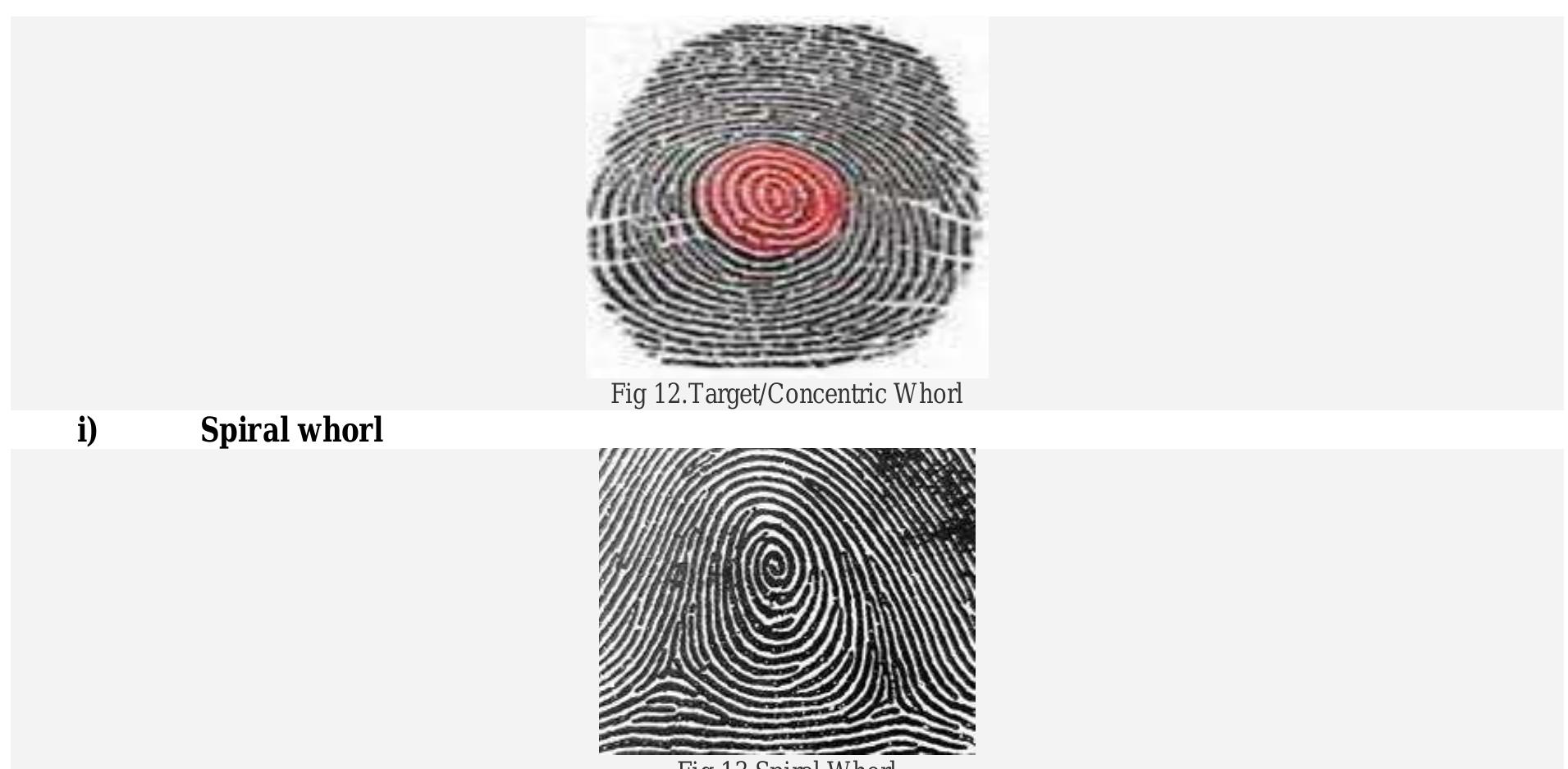 A spiral whorl is characterised circular patterns that are