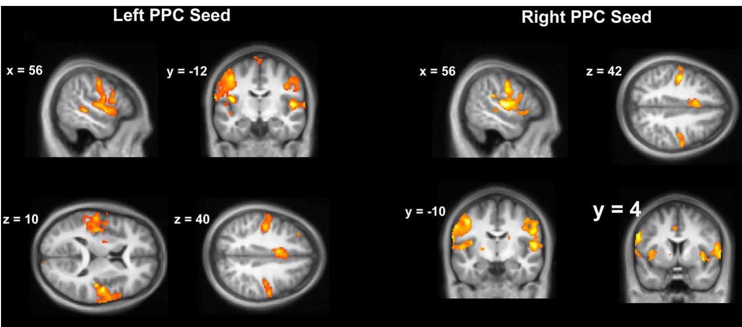 Regions whose functional coupling with ppc nodes in the