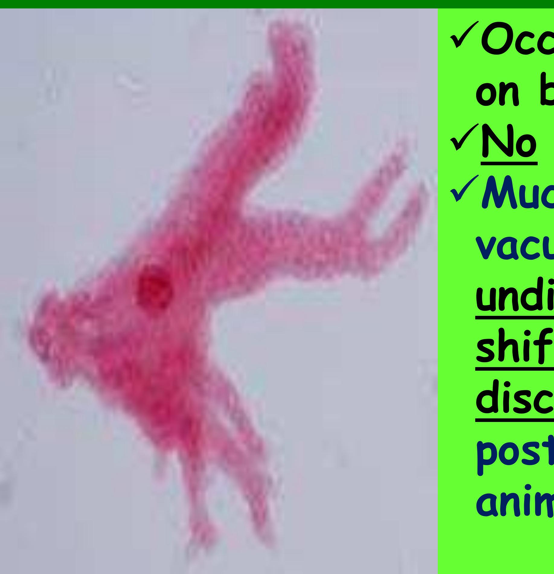 Figure 27 - Amoeba proteus
